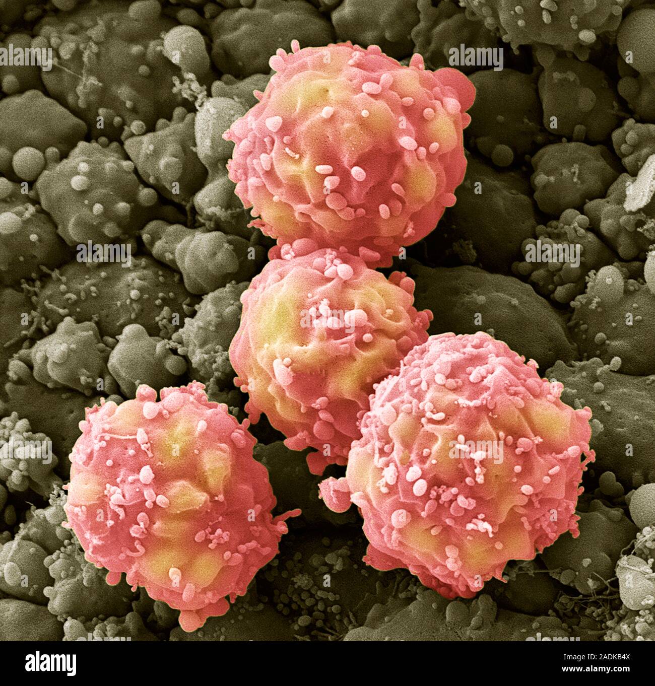 Foetal blood stem cells, coloured scanning electron micrograph (SEM ...