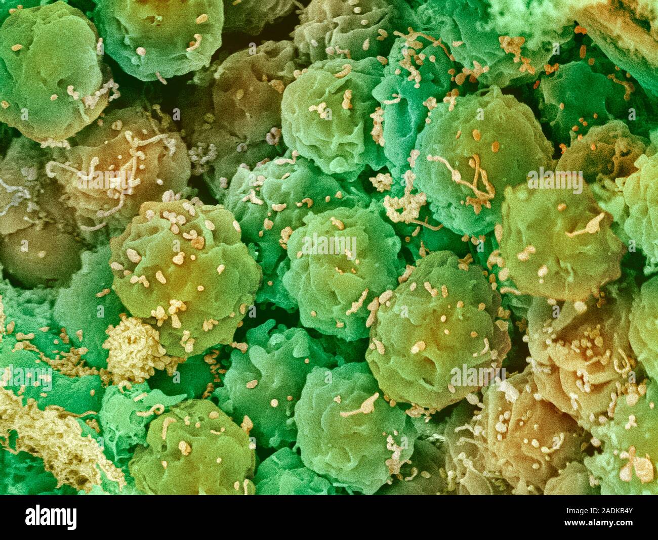 Foetal blood stem cells, coloured scanning electron micrograph (SEM ...