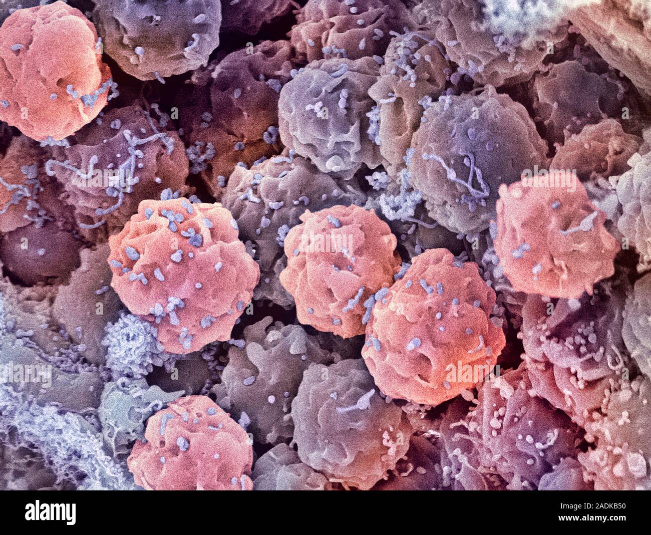 Foetal blood stem cells, coloured scanning electron micrograph (SEM ...