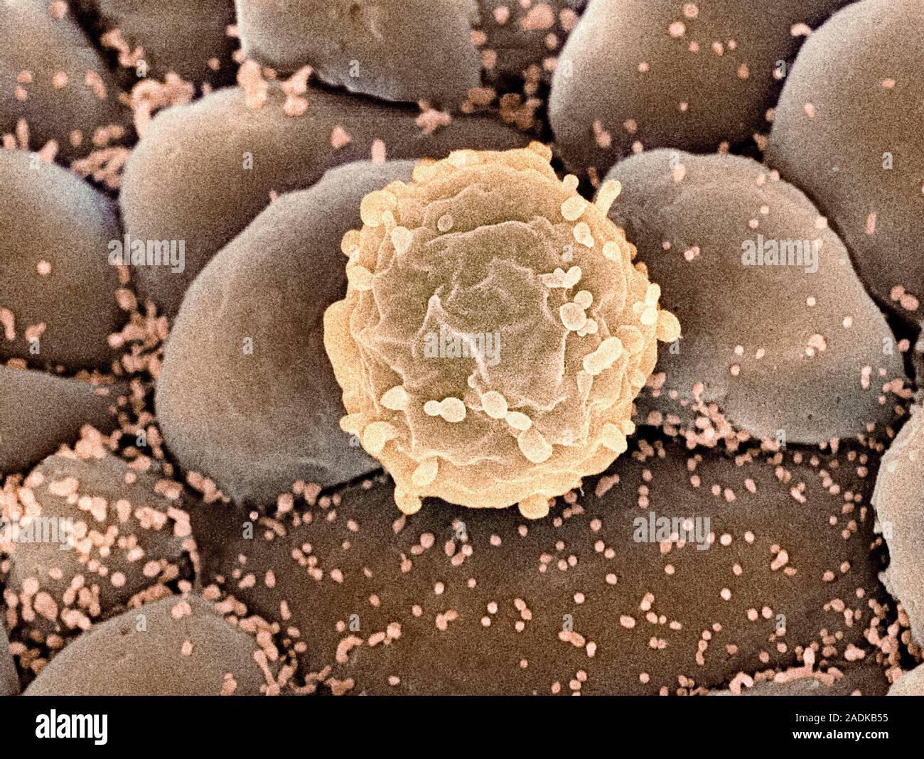 Foetal blood stem cell, coloured scanning electron micrograph (SEM ...