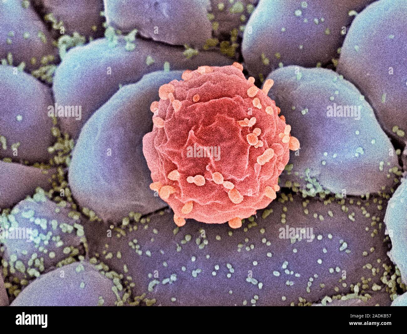 Foetal blood stem cell, coloured scanning electron micrograph (SEM ...
