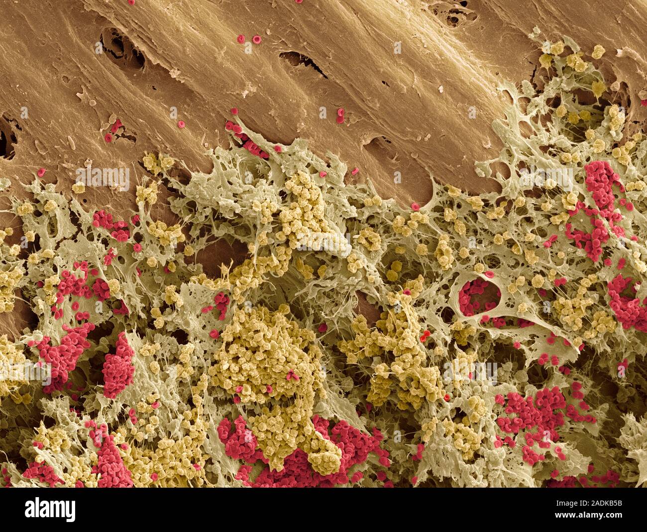 Bone marrow, scanning electron micrograph (SEM). Bone marrow is the ...