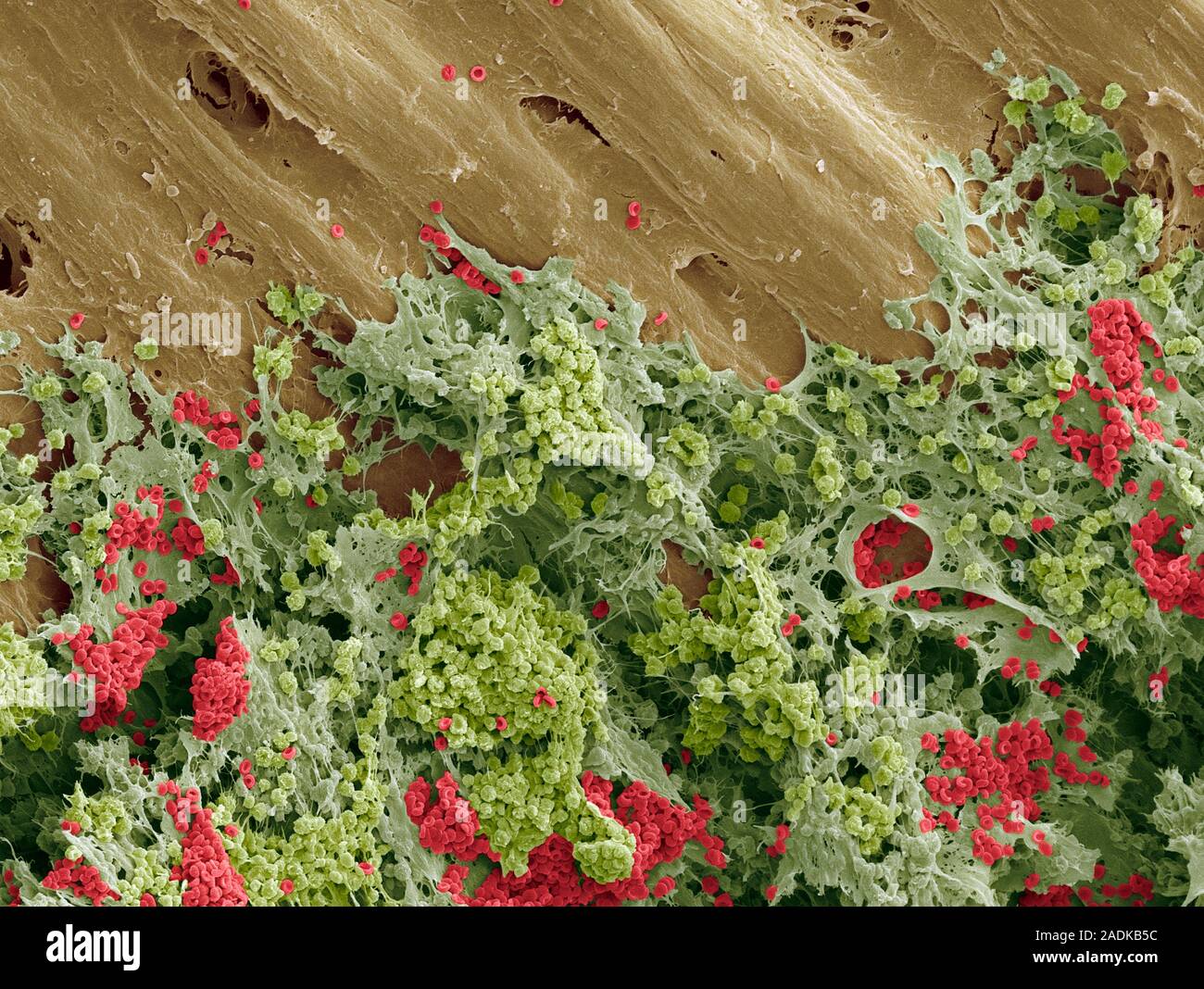 Bone marrow, scanning electron micrograph (SEM). Bone marrow is the ...