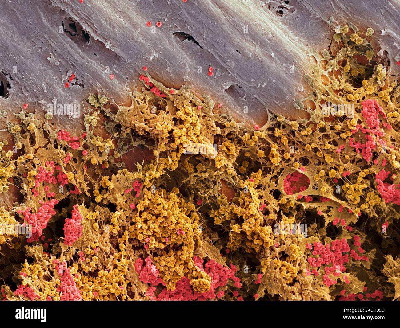 Bone marrow, scanning electron micrograph (SEM). Bone marrow is the ...