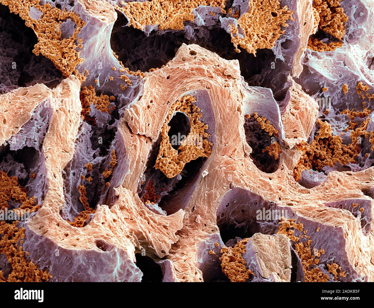 Bone marrow. Scanning electron micrograph (SEM) of bone marrow in ...