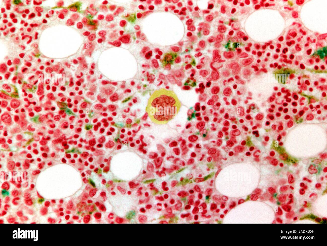 Bone marrow. Light micrograph of a section through a sample of bone ...