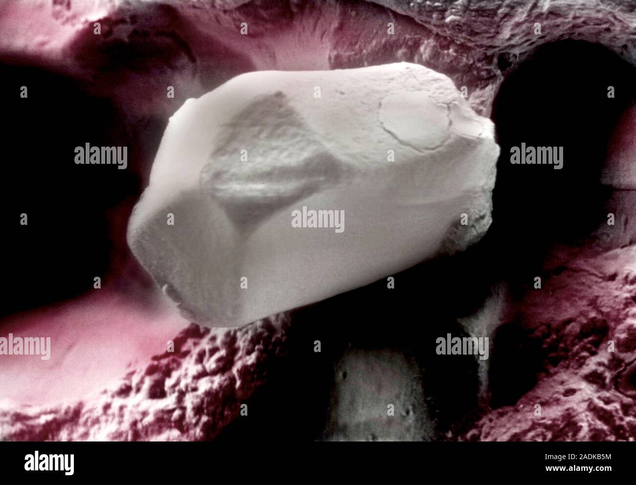 Bone marrow. Coloured scanning electron micrograph (SEM) of bone marrow ...