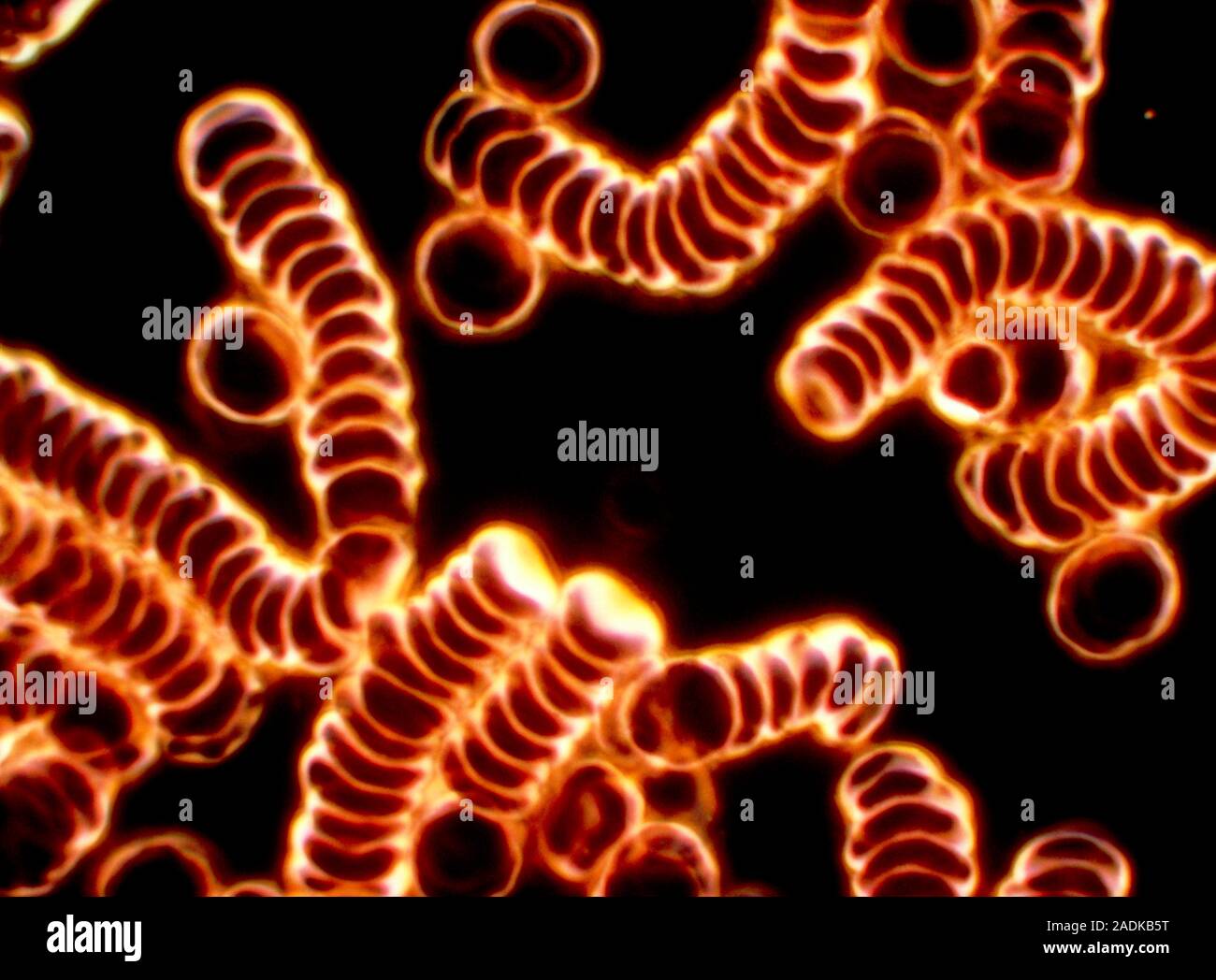 Light micrograph of human red blood cells stacked together like coins ...