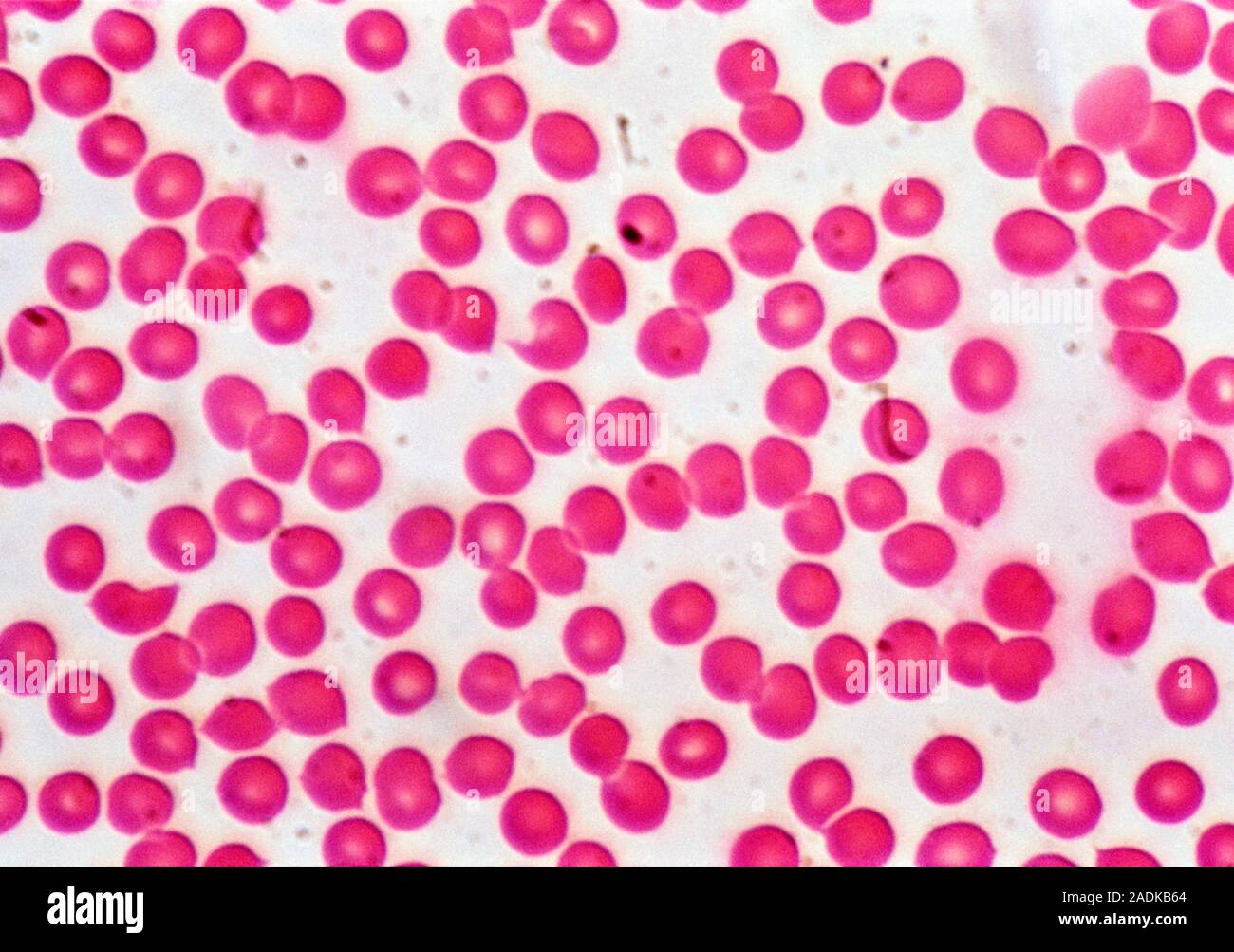 Light micrograph of human red blood cells (erythrocytes), the principal ...
