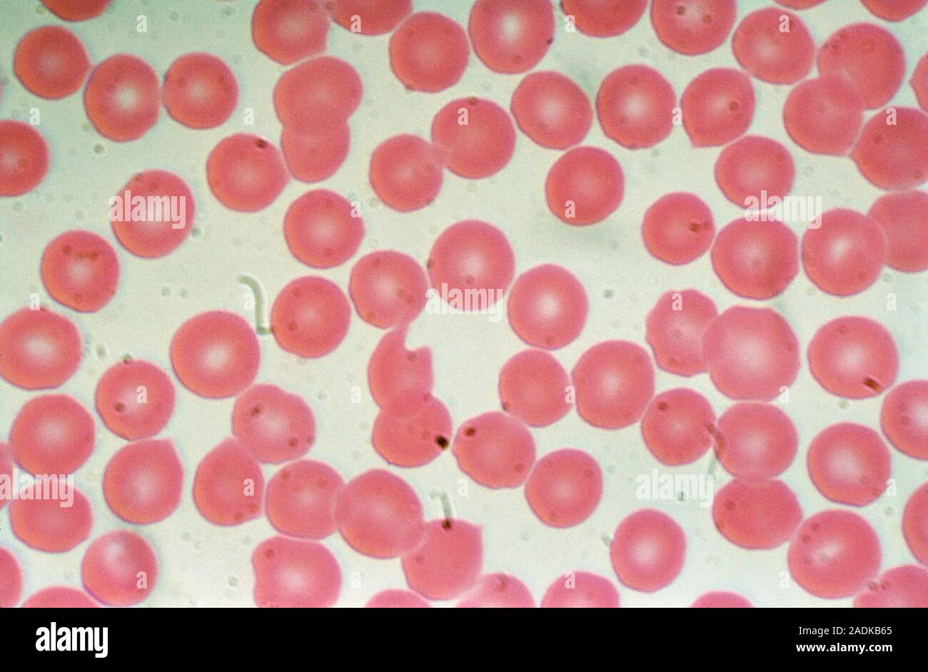 Light micrograph of human red blood cells (erythrocytes), the principal ...