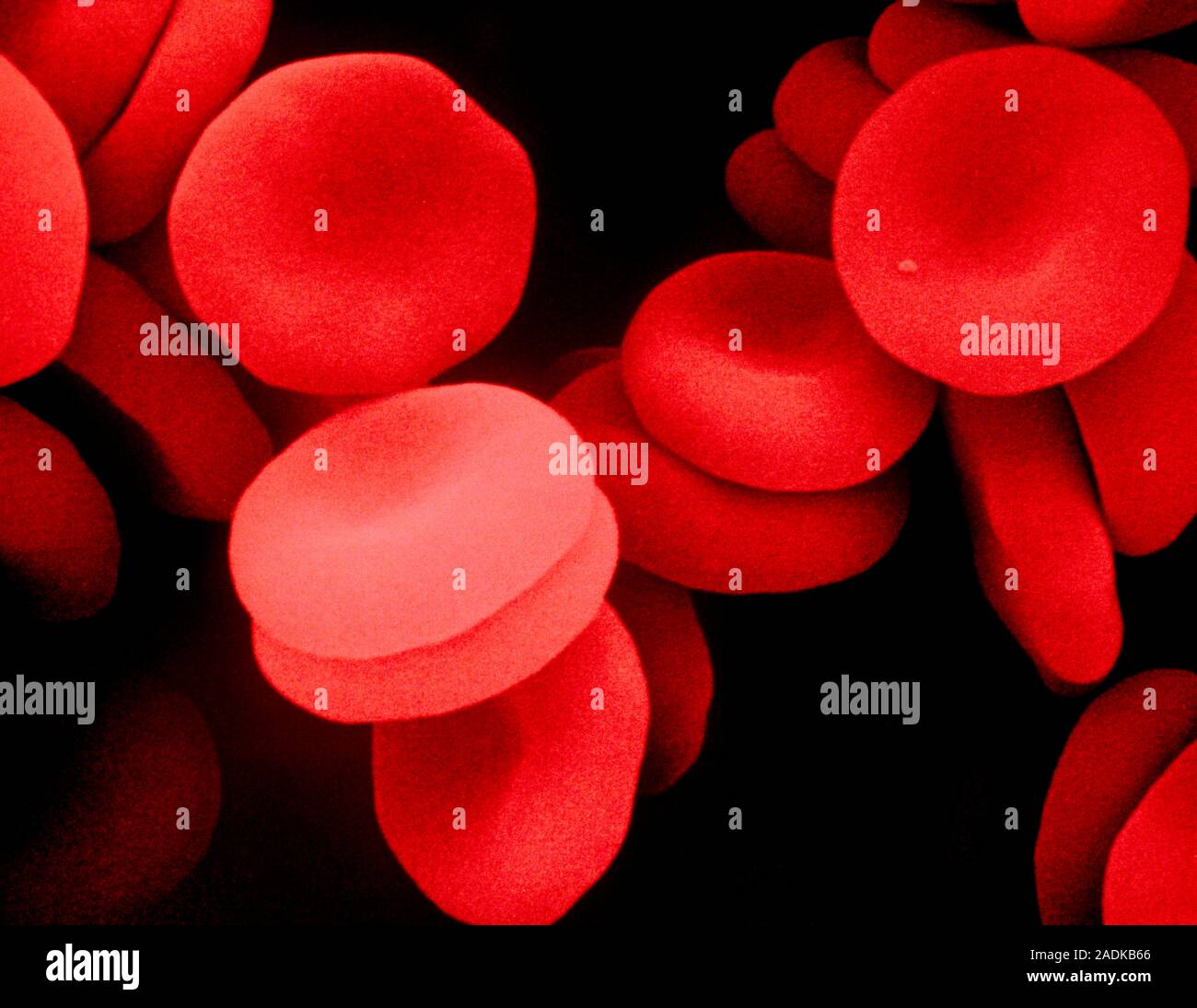 False-colour scanning electron micrograph (SEM) of human red blood ...