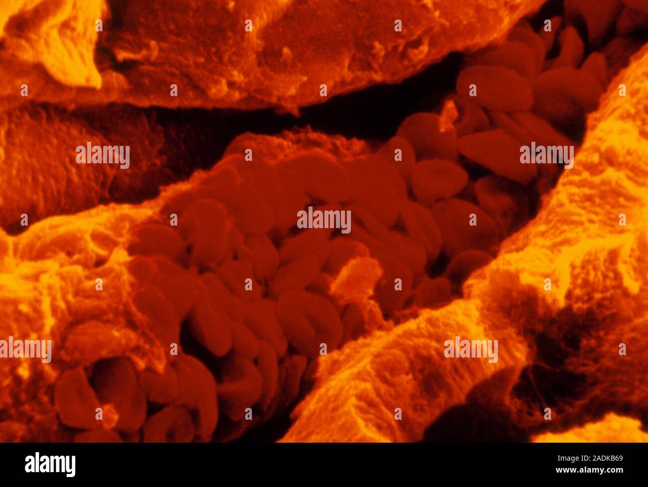 False-colour scanning electron micrograph (SEM) of red blood cells ...