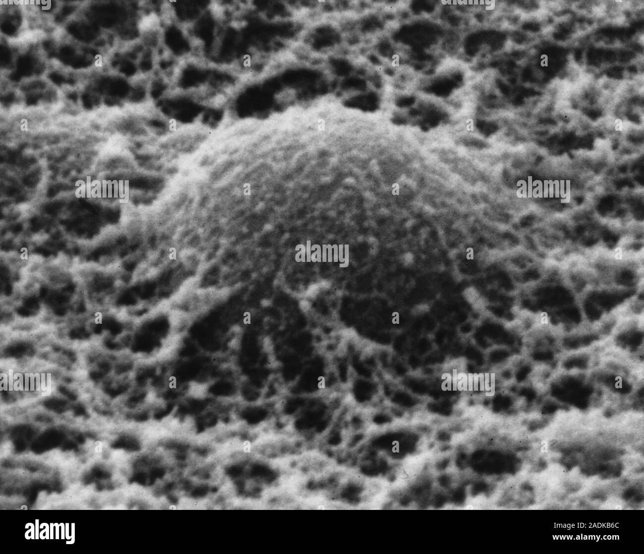 Scanning electron micrograph of a human erythrocyte, or red blood cell ...