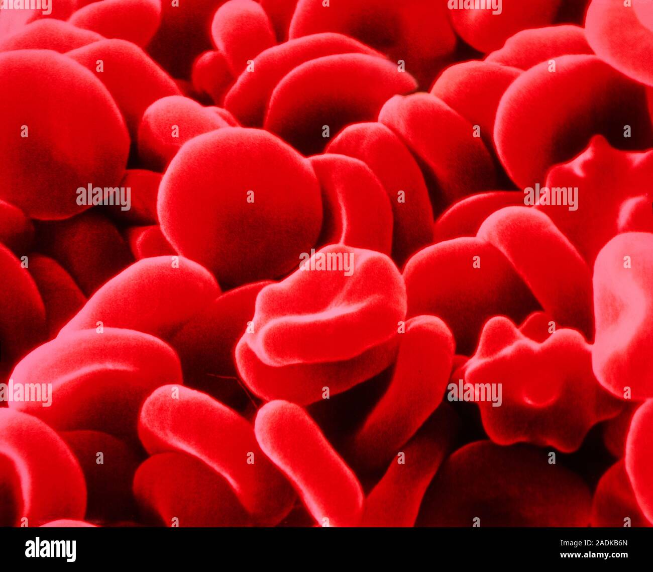 False-colour scanning electron micrograph (SEM) of human red blood ...