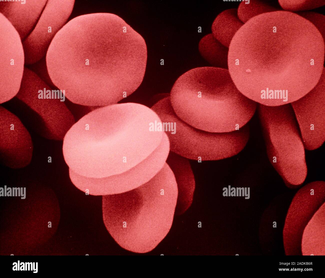 False-colour scanning electron micrograph (SEM) of human red blood ...