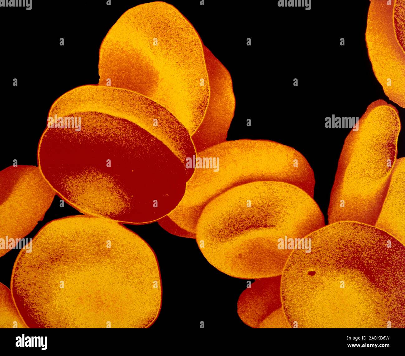 False-colour scanning electron micrograph (SEM) of human red blood ...