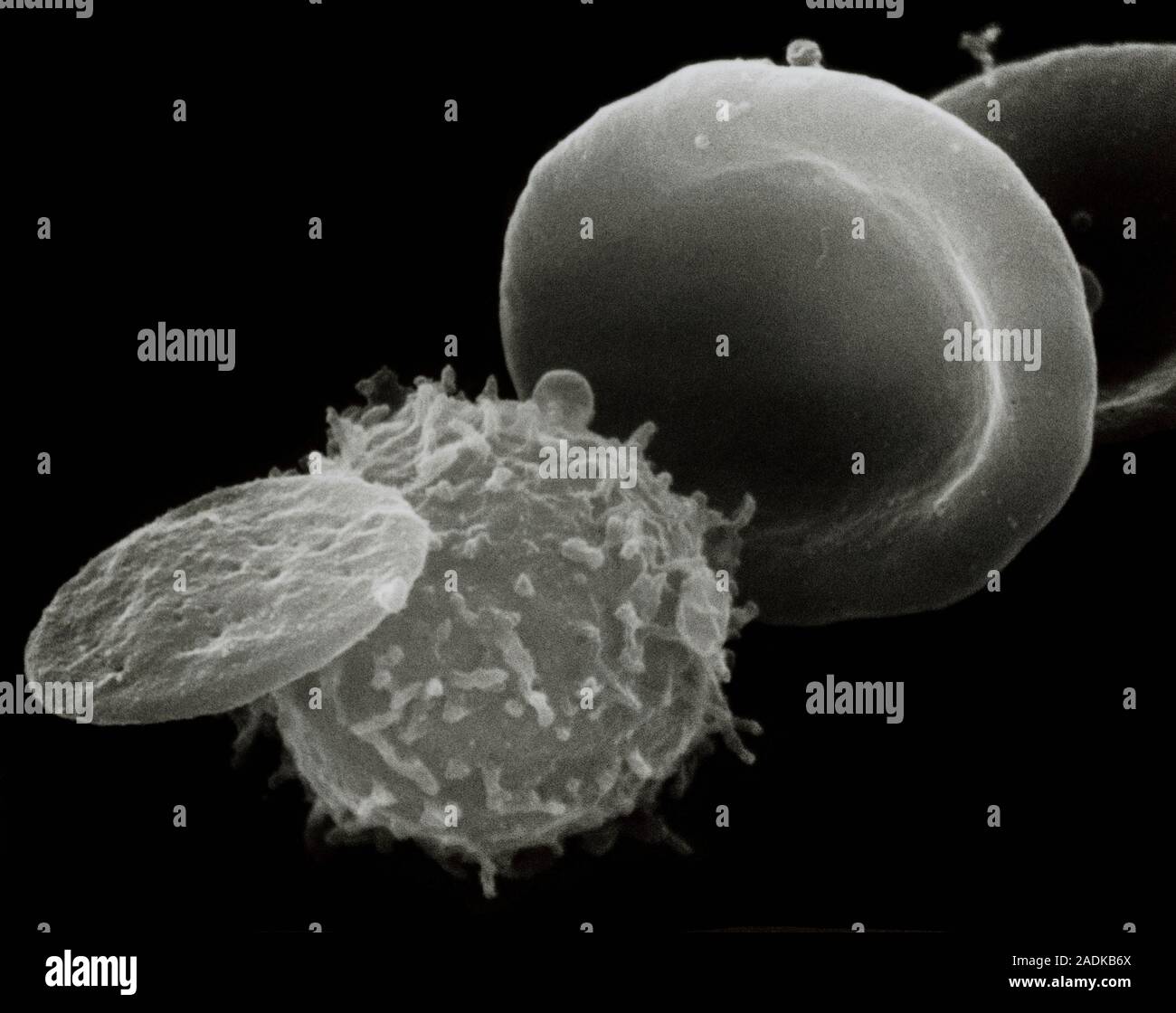 Scanning electron micrograph (SEM) showing three types of cells found ...