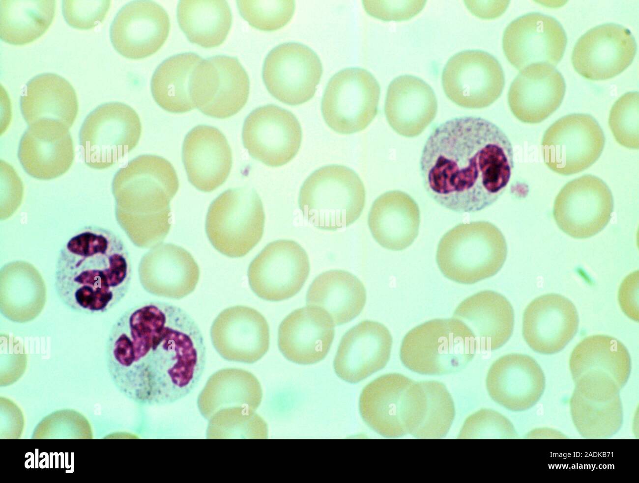 Light micrograph of female human blood cells, showing numerous red ...