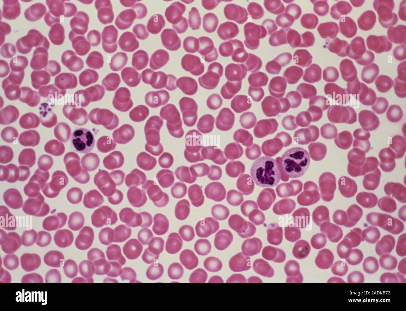 Light micrograph of human blood cells, showing numerous red cells ...