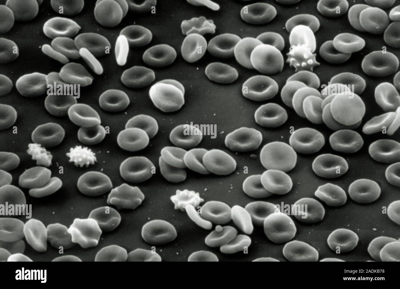 Scanning electron micrograph (SEM) of human red blood cells ...