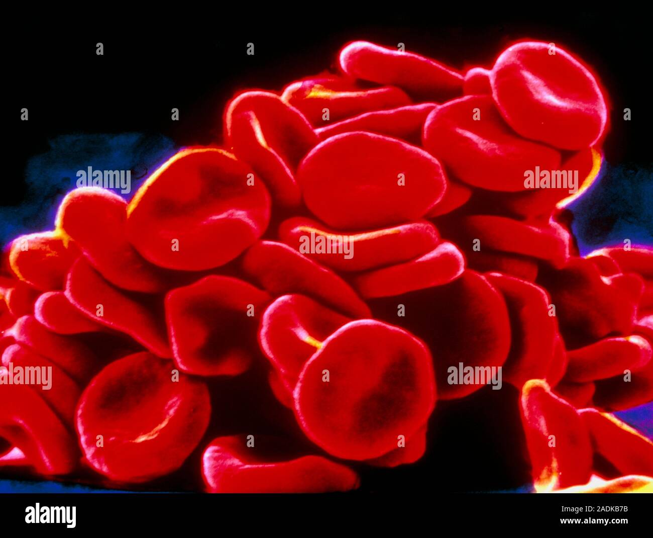 Scanning electron micrograph (SEM) of human red blood cells ...