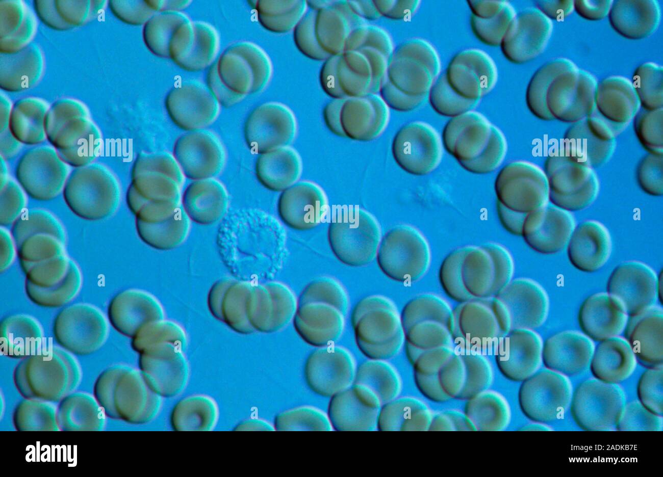 Light micrograph in interference contrast illumination of human blood ...