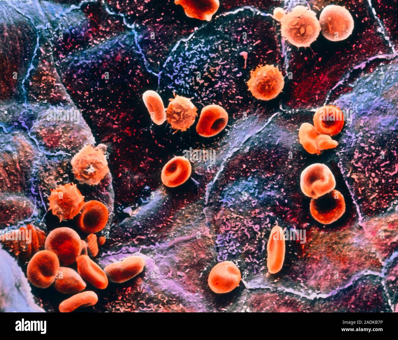 Red Blood cells inside the heart: false-colour scanning electron ...