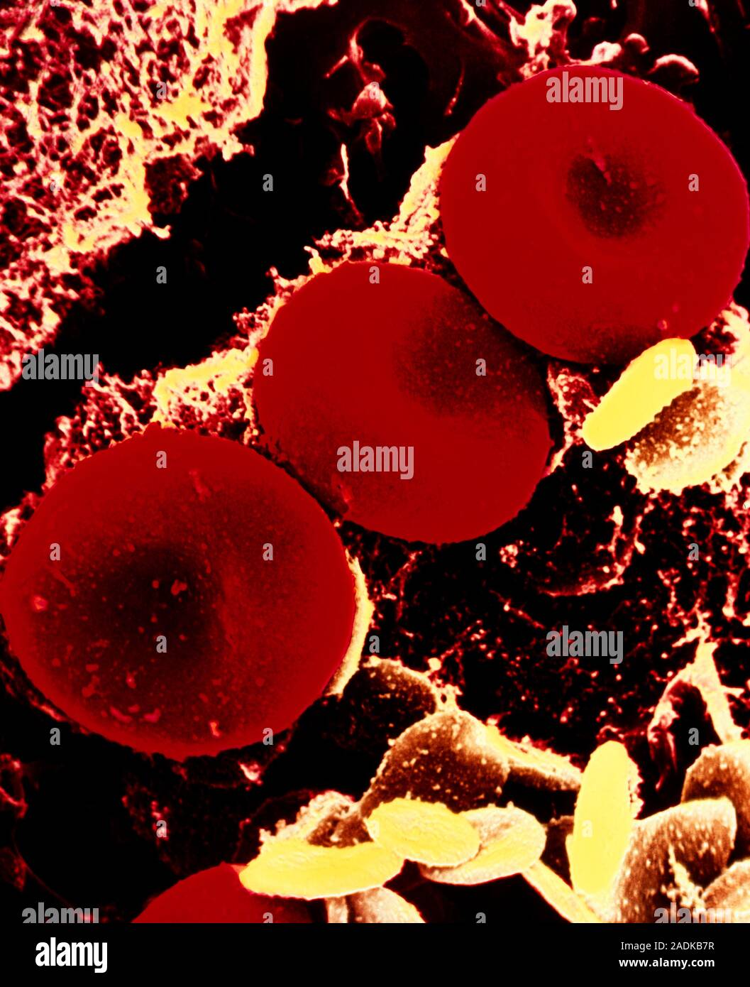 False-colour scanning electron micrograph (SEM) of three human red ...