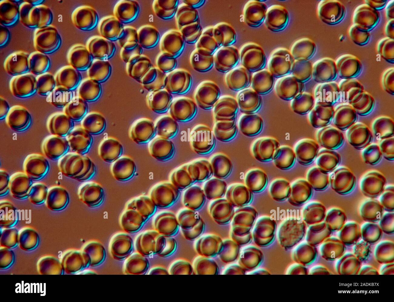 Red blood cells. Light micrograph of a group of red blood cells ...