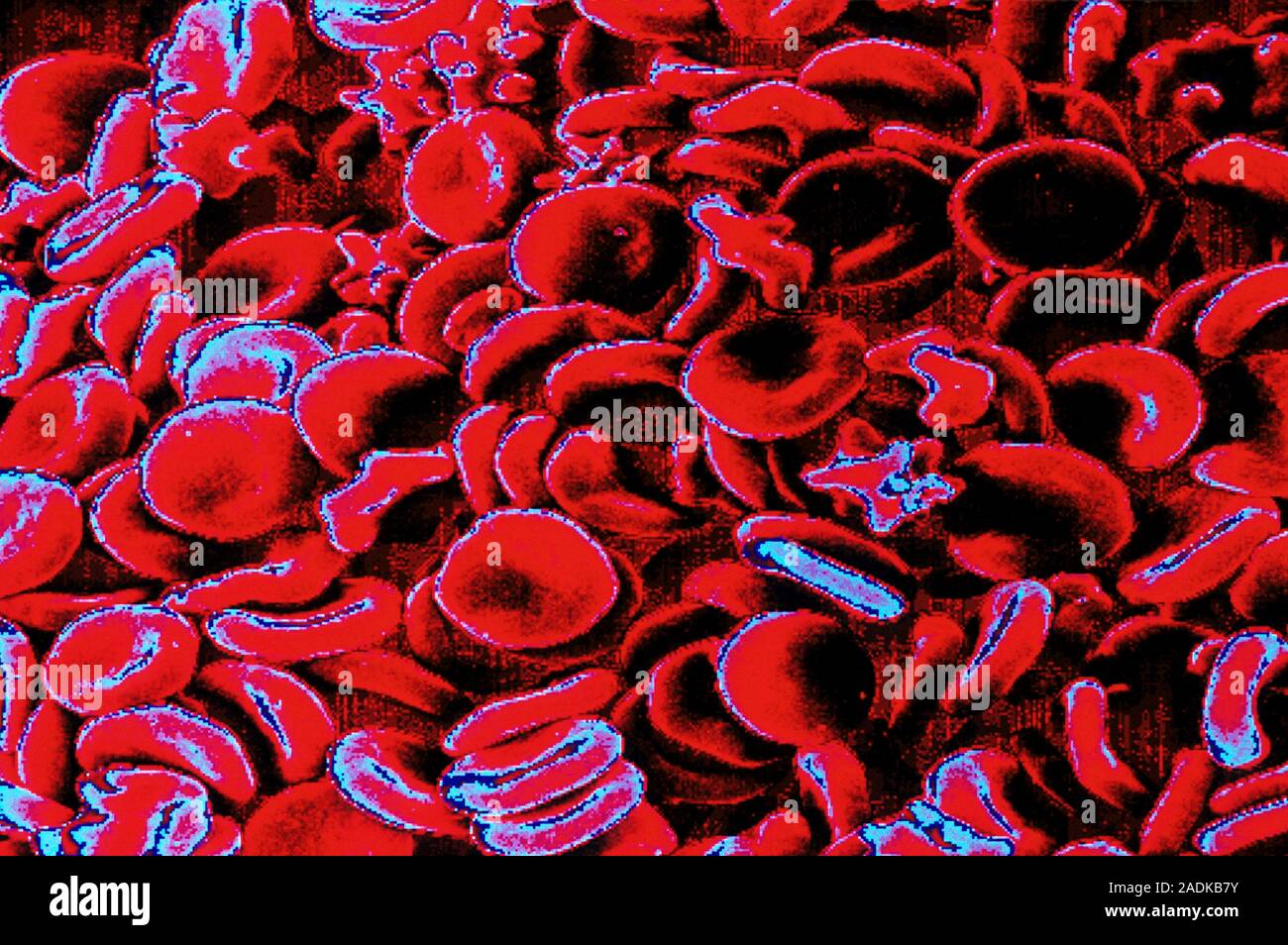 Digitised-colour scanning electron micrograph (SEM) of human red blood ...