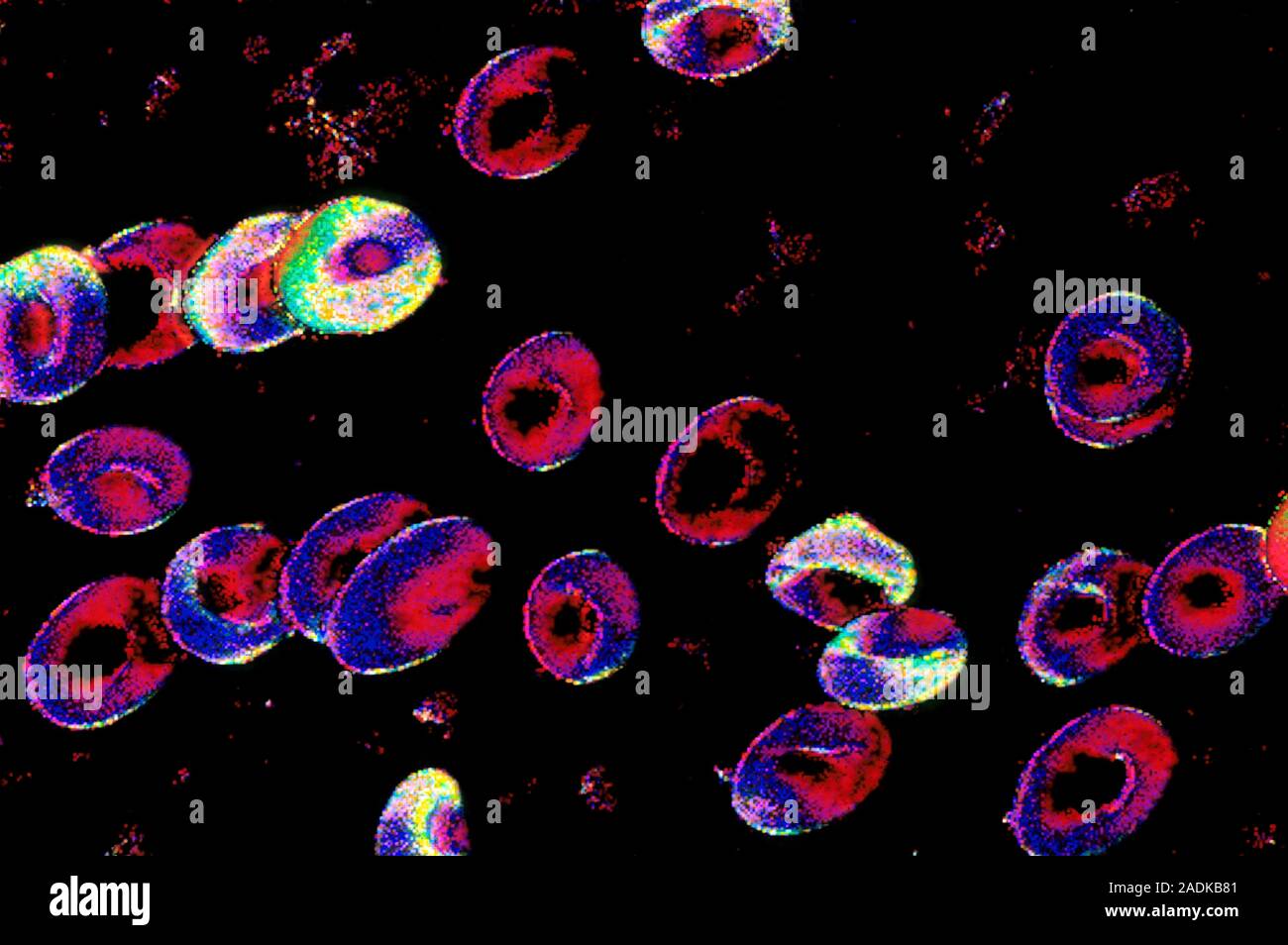 Digitised-colour scanning electron micrograph (SEM) of human red blood ...