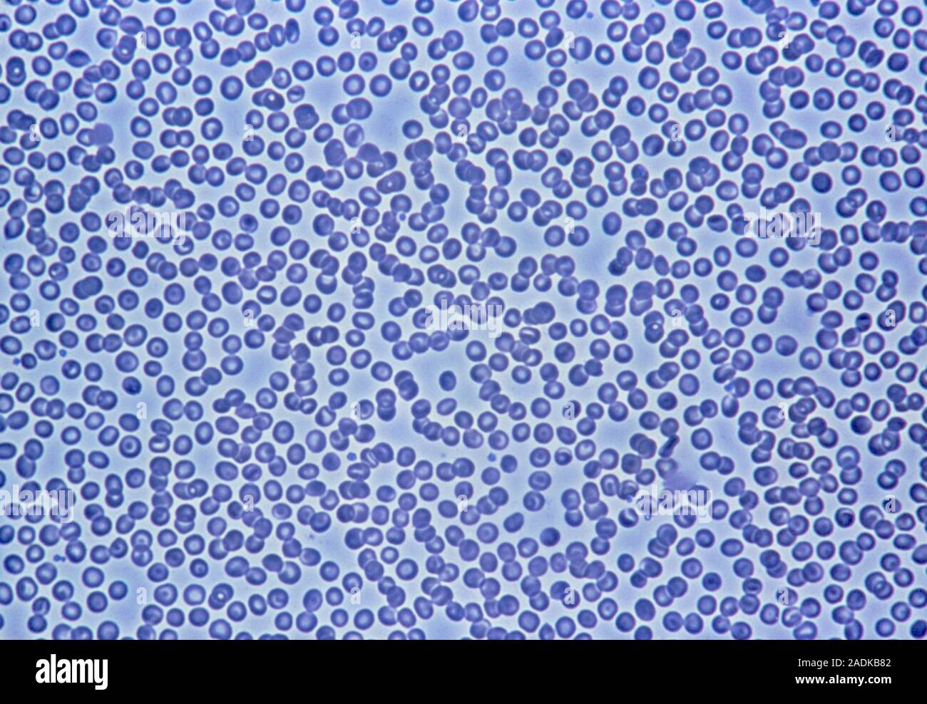 Red blood cells. Light micrograph of a group of red blood cells ...
