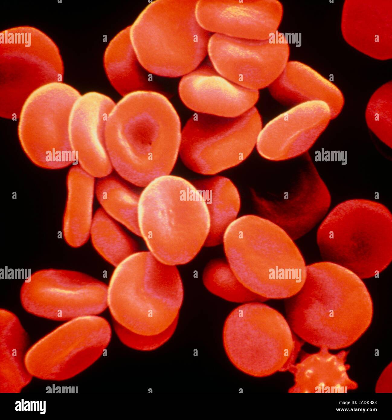 False-colour scanning electron micrograph (SEM) of human red blood ...