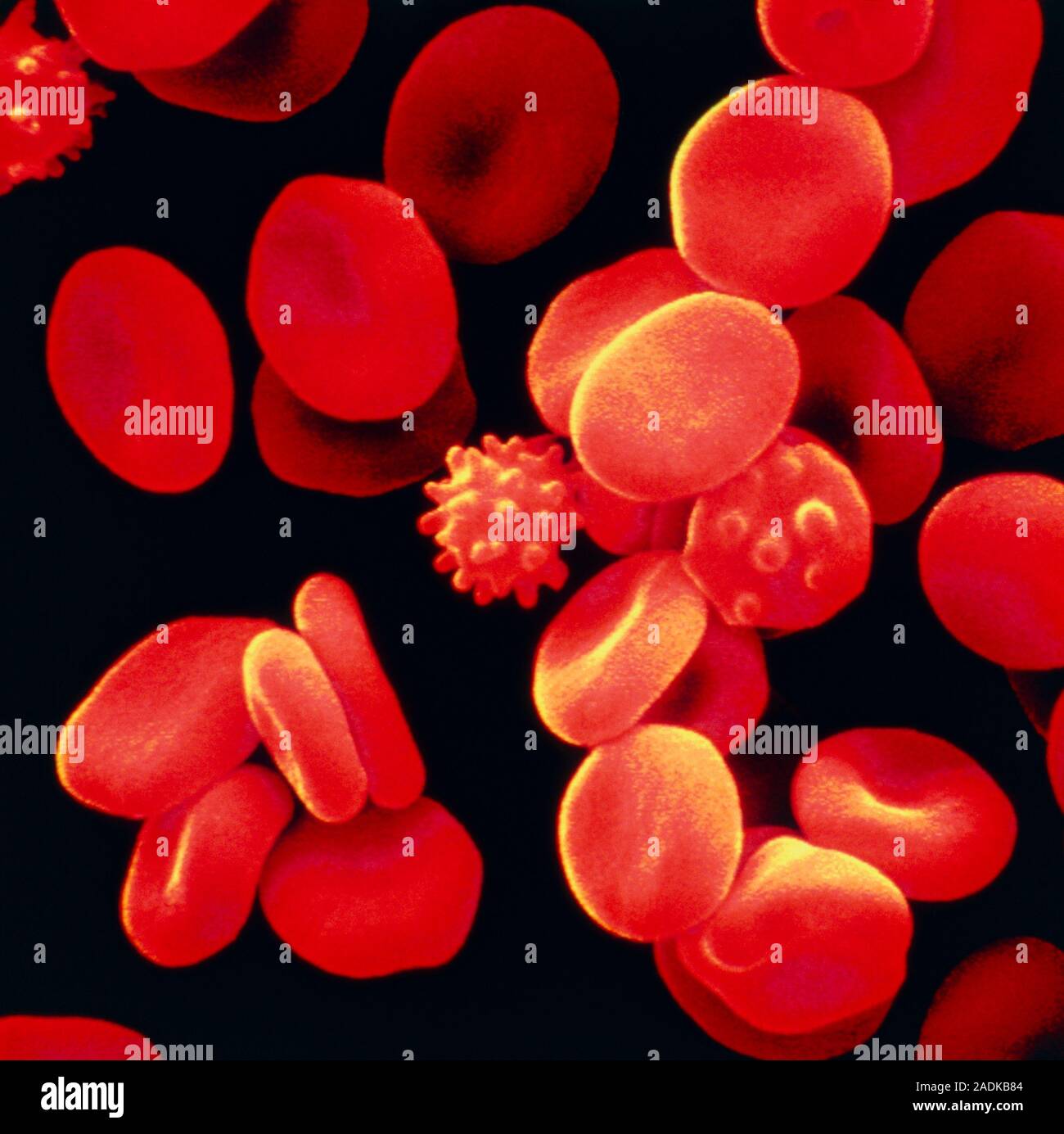 False-colour scanning electron micrograph (SEM) of human red blood ...
