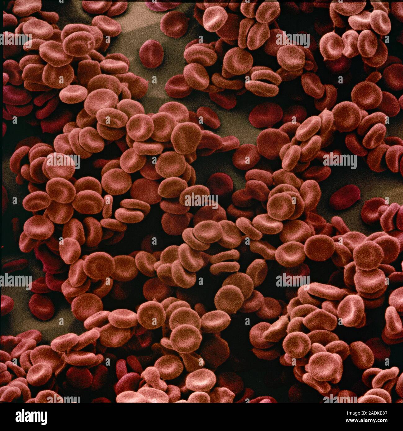 Red blood cells. Coloured scanning electron micro- graph (SEM) of ...