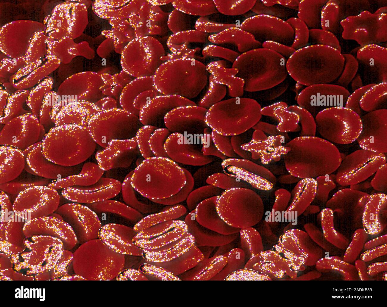 Red blood cells. Digitised coloured Scanning Electron Micrograph (SEM ...
