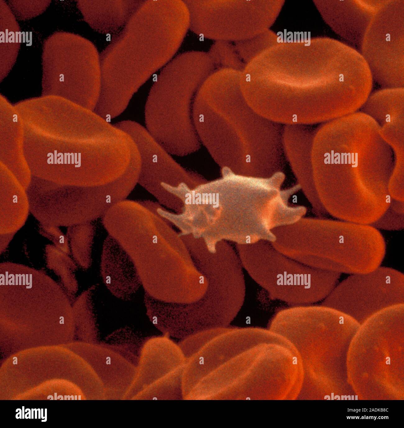 Platelet. Coloured Scanning Electron Micrograph (SEM) of a blood ...