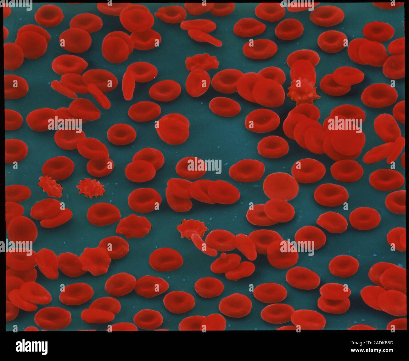Coloured scanning electron micrograph of human red blood cells ...