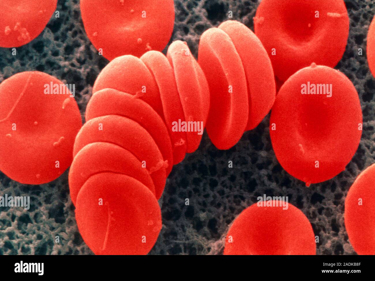 Red blood cells. Coloured scanning electron micrograph of red blood ...