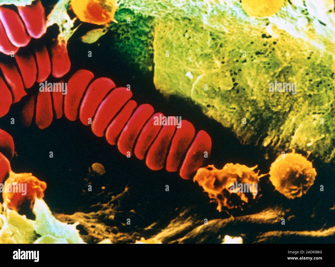 Red blood cells. Coloured scanning electron micro- graph of red blood ...