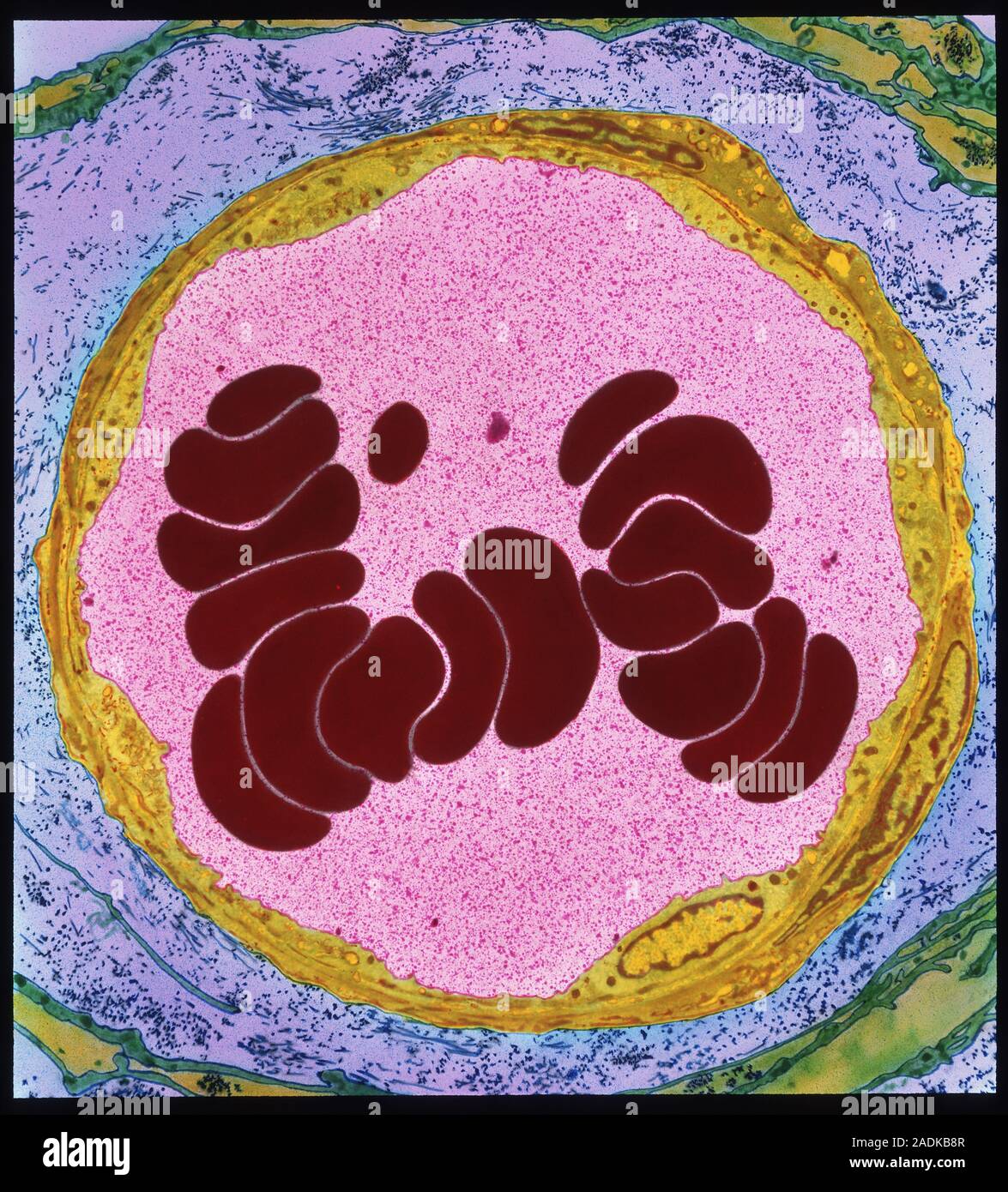 Red blood cells. Coloured transmission electron micrograph (TEM) of a ...