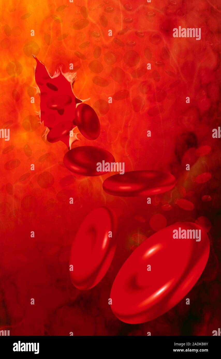 Red blood cells. Computer artwork of red blood cells spilling from a ...