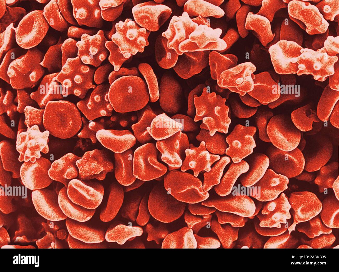 Red blood cells. Coloured scanning electron micrograph of red blood ...