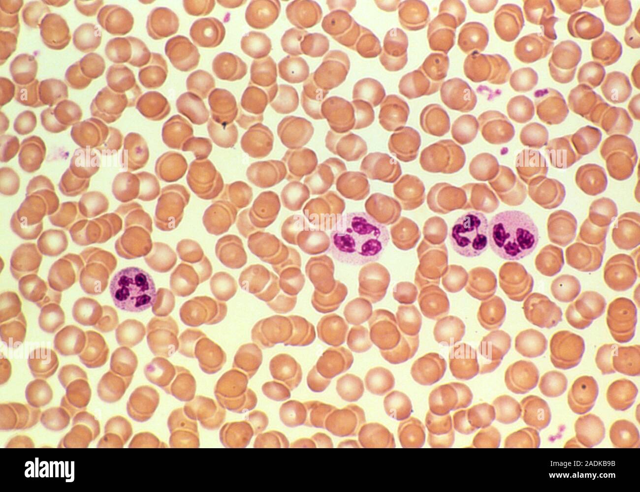 Healthy blood smear. Light micrograph of a smear of human blood ...