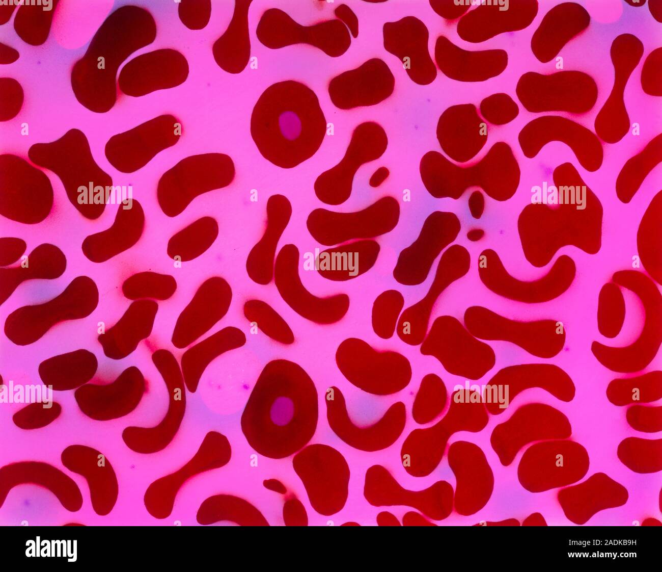 Red blood cells. Coloured transmission electron micrograph (TEM) of a ...