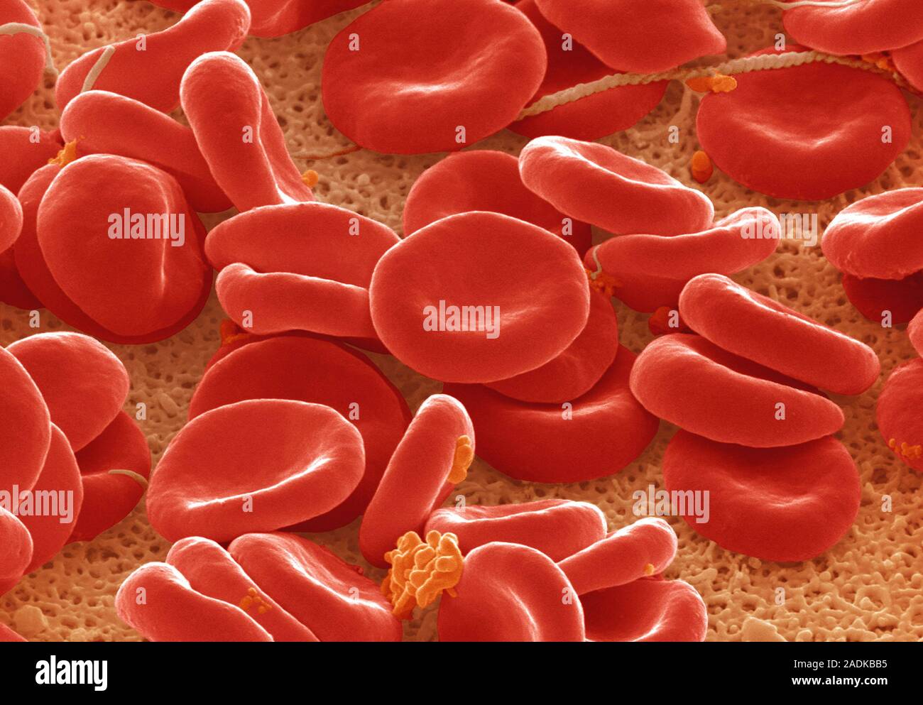 Red blood cells. Coloured scanning electron micrograph (SEM) of a group ...