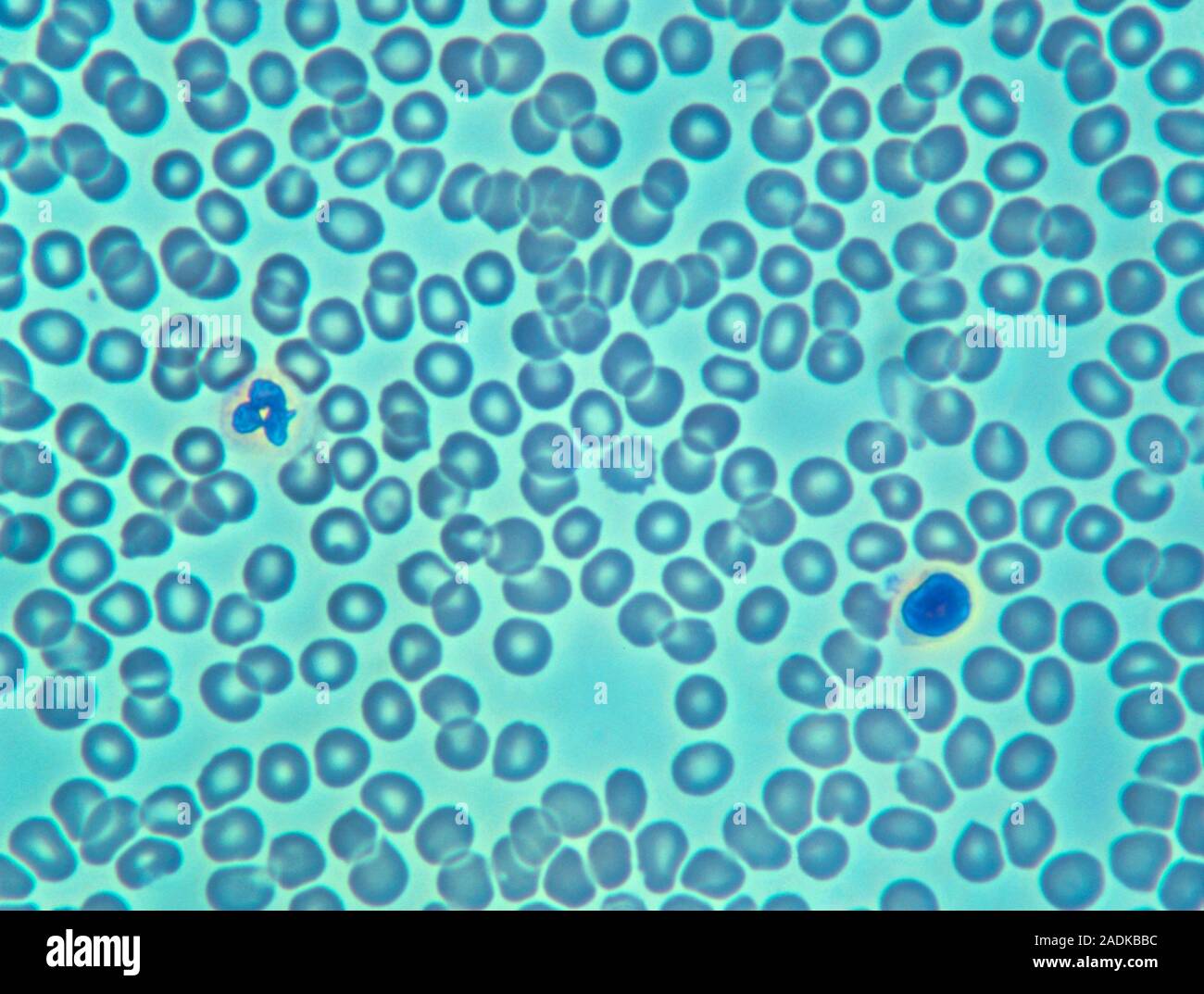 Blood cells. Light micrograph of healthy human blood cells. Two white ...