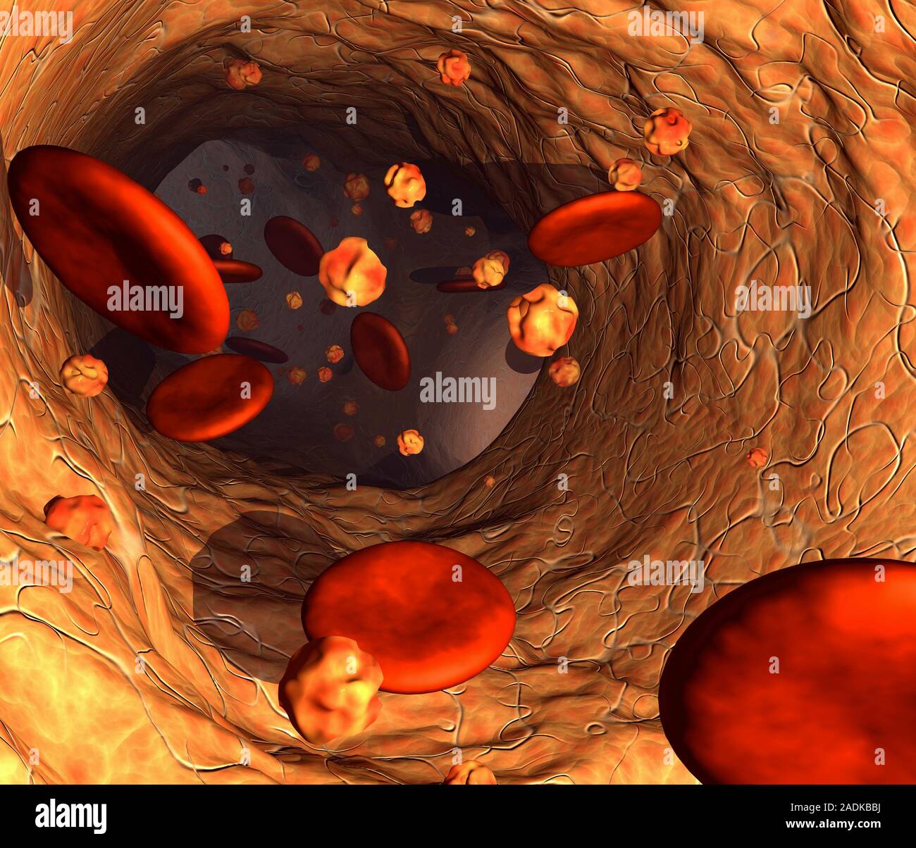Red blood cells. Computer artwork of red blood cells and platelets ...