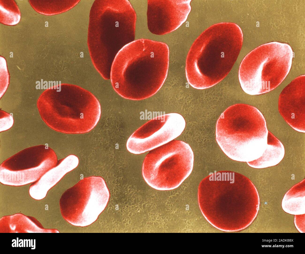Red blood cells. Coloured scanning electron micrograph (SEM) of red ...
