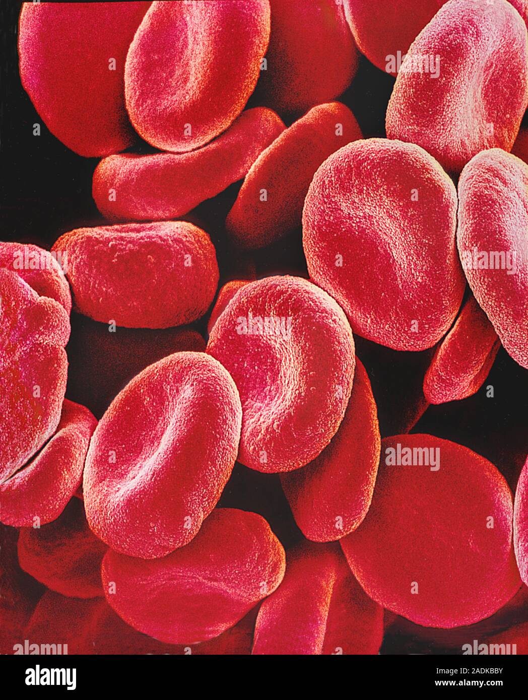 Red blood cells. Coloured scanning electron micrograph (SEM) of human ...